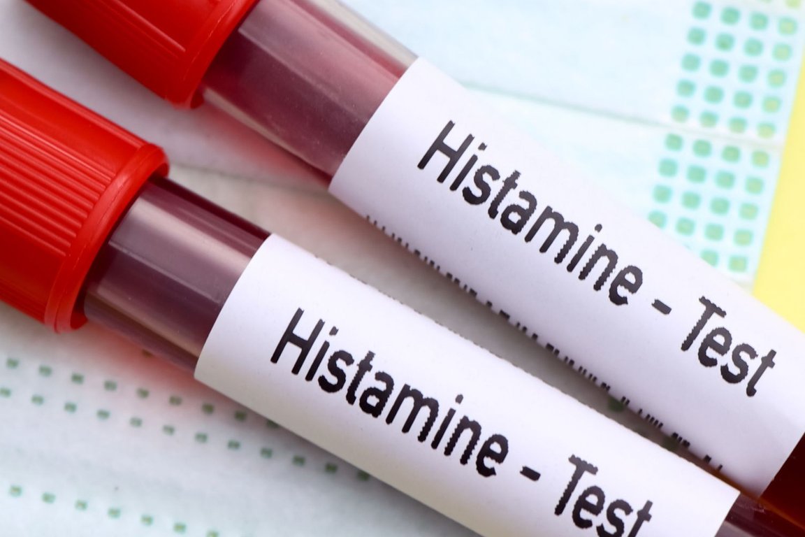 Histaminintoleranz – Ursachen, Symptome und Hilfe aus der Apotheke
